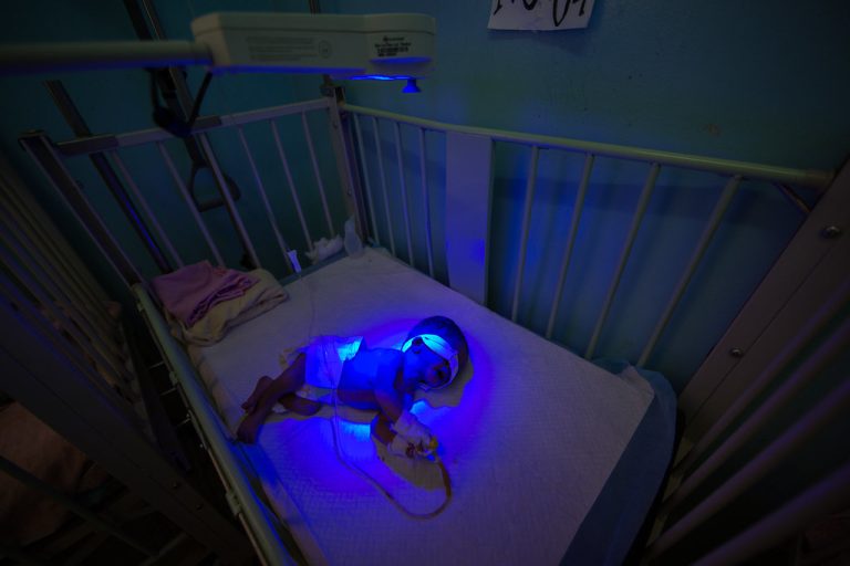 Phototherapy for Jaundice Effective Treatment for Newborns